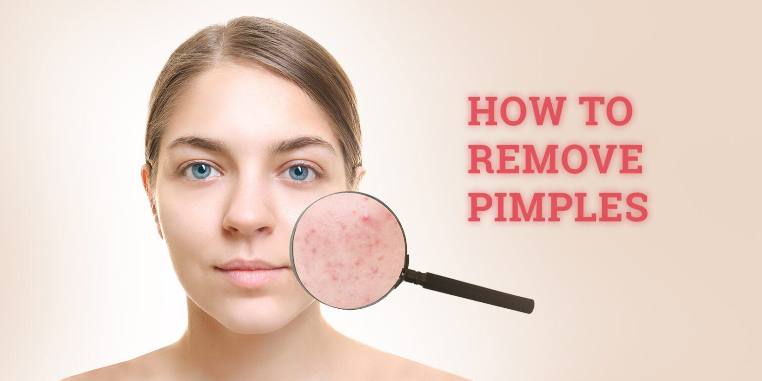 Skincare Simple Tips to Prevent Pimples - DocPe